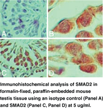 SMAD2 Polyclonal Antibody