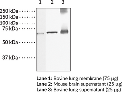 Guanylate Cyclase β1 subunit (soluble) Polyclonal Antibody