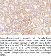 TGR5 (C-Term) Polyclonal Antibody