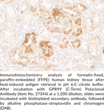 GPR99 (C-Term) Polyclonal Antibody