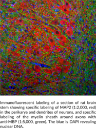 MAP2 (human) Polyclonal Antibody