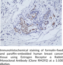 Estrogen Receptor α Rabbit Monoclonal Antibody (Clone RM292)