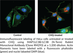 MAP1LC3B/LC3B (N-Term) Rabbit Monoclonal Antibody (Clone RM293)
