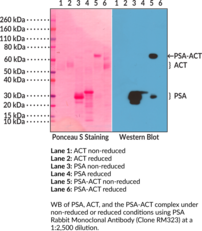 PSA Rabbit Monoclonal Antibody (Clone RM323)