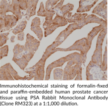 PSA Rabbit Monoclonal Antibody (Clone RM323)