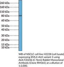 ALK/CD246 (C-Term) Rabbit Monoclonal Antibody (Clone RM361)