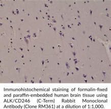 ALK/CD246 (C-Term) Rabbit Monoclonal Antibody (Clone RM361)