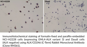 ALK/CD246 (C-Term) Rabbit Monoclonal Antibody (Clone RM361)