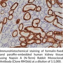Napsin A (N-Term) Rabbit Monoclonal Antibody (Clone RM366)