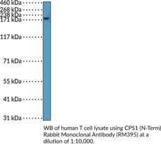 CPS1 (N-Term) Rabbit Monoclonal Antibody (RM395)