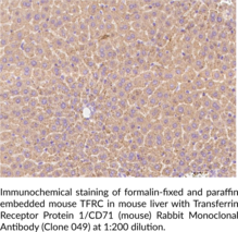 Transferrin Receptor Protein 1/CD71 (mouse) Rabbit Monoclonal Antibody ...