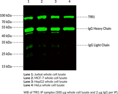 Transferrin Receptor Protein 1/CD71 (human) Rabbit Monoclonal Antibody ...
