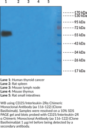 CD25/Interleukin-2Rα Chimeric Monoclonal Antibody (aa 116-122) (Clone ...