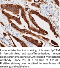 EpCAM Rabbit Monoclonal Antibody (Clone 28)