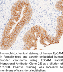 EpCAM Rabbit Monoclonal Antibody (Clone 28)