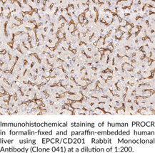 EPCR/CD201 Rabbit Monoclonal Antibody (Clone 041)