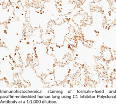 C1 Inhibitor Polyclonal Antibody