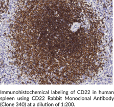 CD22 Rabbit Monoclonal Antibody (Clone 340)