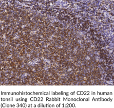 CD22 Rabbit Monoclonal Antibody (Clone 340)