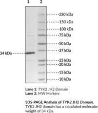 TYK2 JH2 Domain (human, recombinant; aa 575-869)