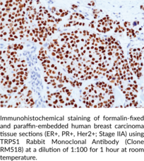 TRPS1 Rabbit Monoclonal Antibody (Clone RM518)