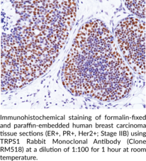 TRPS1 Rabbit Monoclonal Antibody (Clone RM518)
