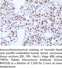TRPS1 Rabbit Monoclonal Antibody (Clone RM518)