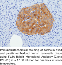 SV2A Rabbit Monoclonal Antibody (Clone RM520)