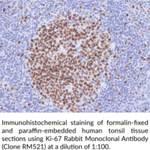 Ki-67 Rabbit Monoclonal Antibody (Clone RM521)