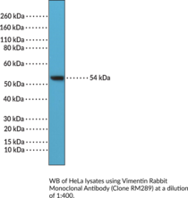 Vimentin Rabbit Monoclonal Antibody (Clone RM289)