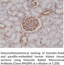 Vimentin Rabbit Monoclonal Antibody (Clone RM289)