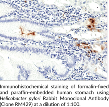 Helicobacter pylori Rabbit Monoclonal Antibody (Clone RM429)