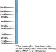 MERTK (mouse) Rabbit Monoclonal Antibody (Clone RM469) (MER, c-Mer ...
