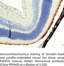 MERTK (mouse) Rabbit Monoclonal Antibody (Clone RM469)