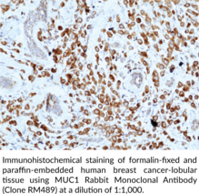 MUC1 Rabbit Monoclonal Antibody (Clone RM489)