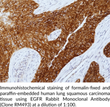 EGFR Rabbit Monoclonal Antibody (Clone RM493)