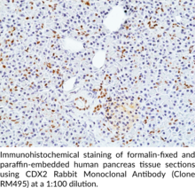 CDX2 Rabbit Monoclonal Antibody (Clone RM495)