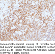 CD45 Rabbit Monoclonal Antibody (Clone RM497)