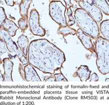 VISTA Rabbit Monoclonal Antibody (Clone RM503)