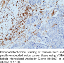 VISTA Rabbit Monoclonal Antibody (Clone RM503)