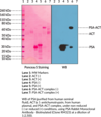 PSA Rabbit Monoclonal Antibody - Biotinylated (Clone RM323)
