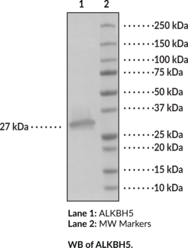ALKBH5 (human, recombinant)