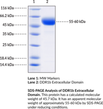 DDR1b Extracellular Domain (human, recombinant)